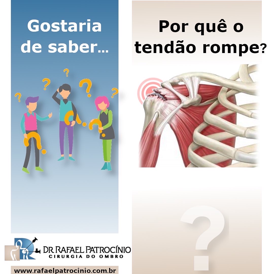 Por quê o tendão do manguito rotador rompe? - Dr. Rafael Patrocínio